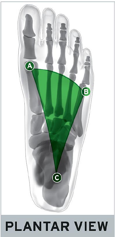 Common Causes of Plantarfasciitis - Elite Sports and Spine Chiropractic